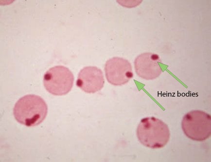 Peds Question of the Month: Recognize Evidence of Heinz Bodies