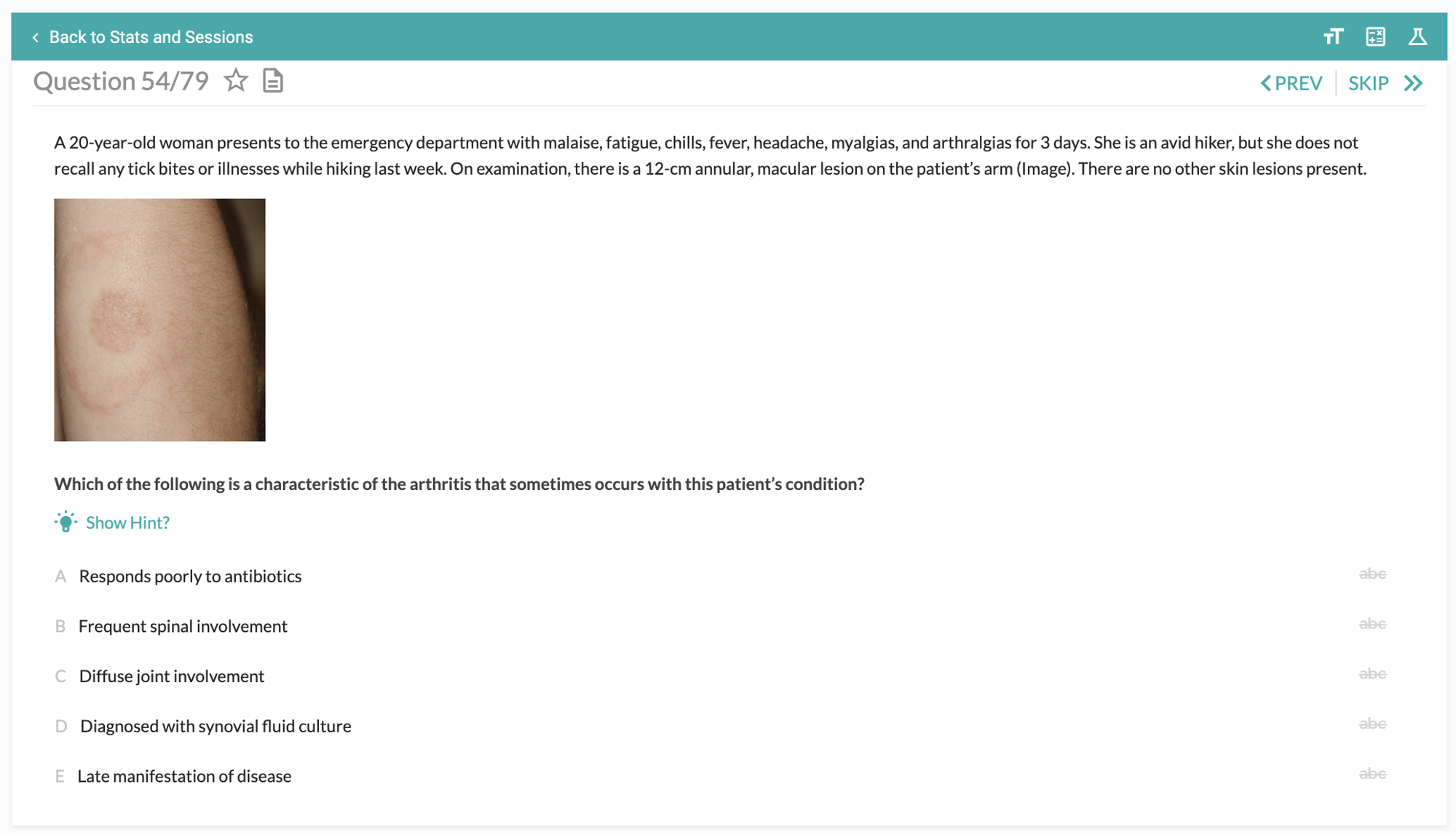 6 tips to break down the USMLE question format