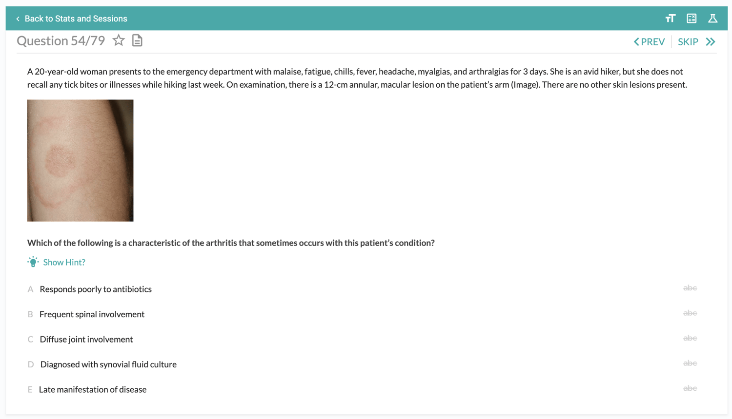 6 tips to break down the USMLE question format