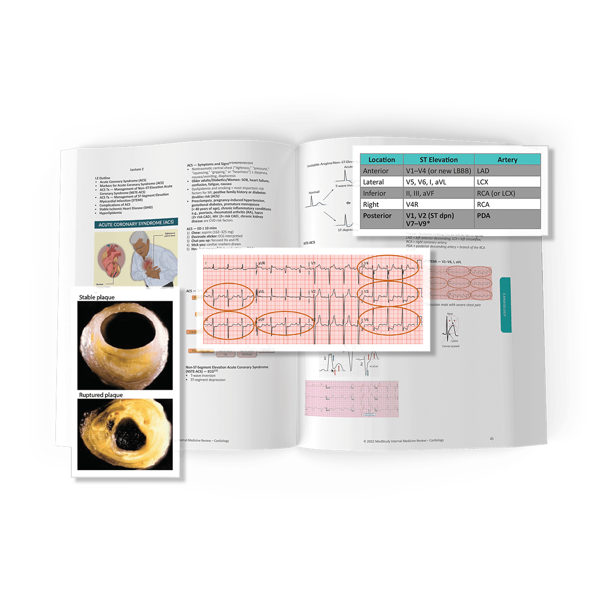 Everything You Need to Know about Studying with Internal Medicine Board ...